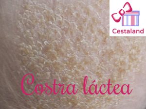 ¿Qué es la costra láctea?¿Cómo quitar la costra láctea sin dañar el ...